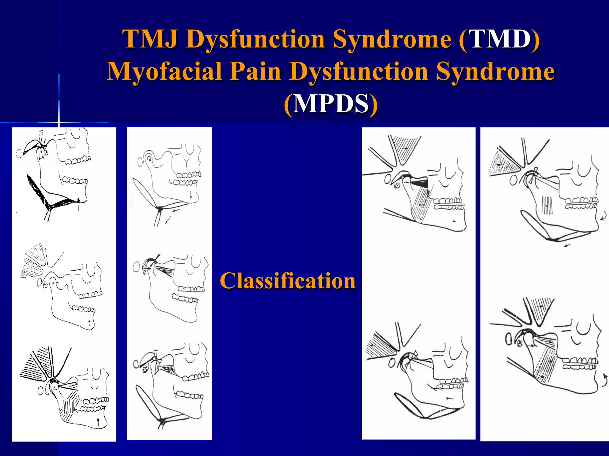 Temporomandibular joint disorder | PPT