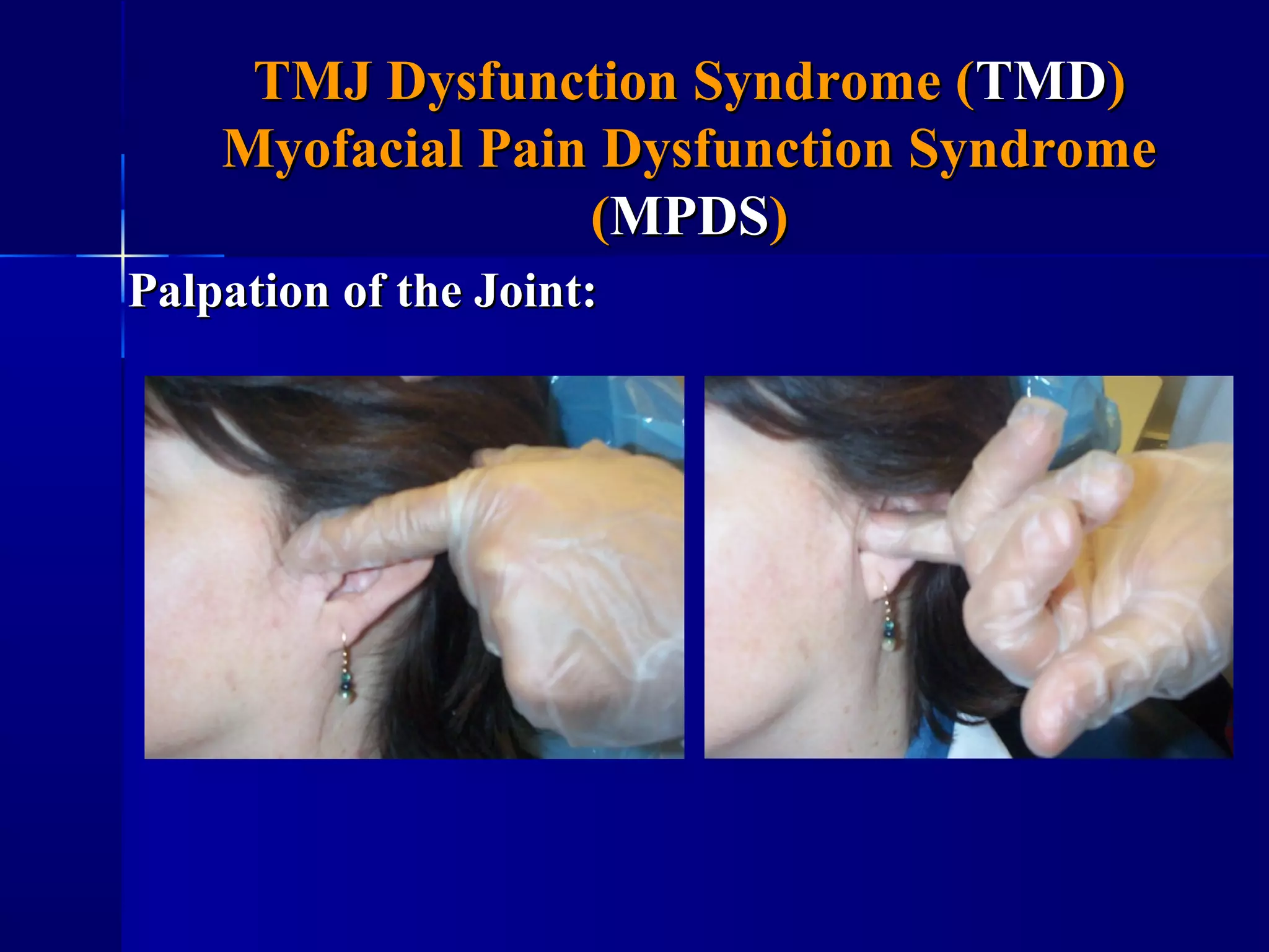Temporomandibular joint disorder | PPT
