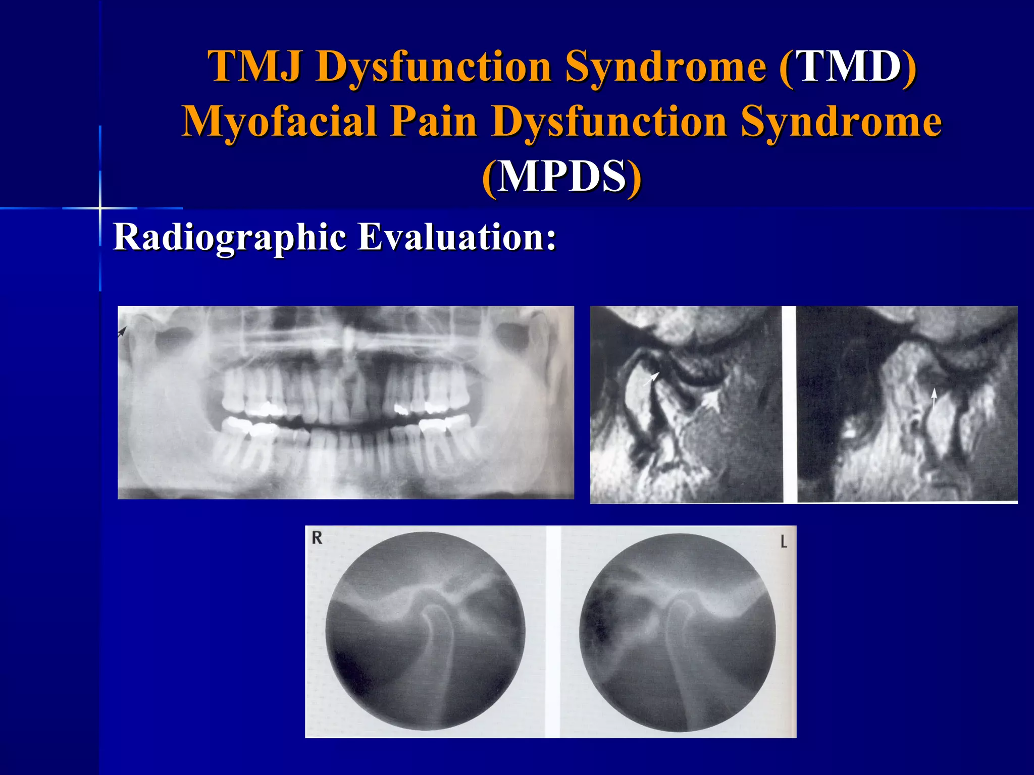 Temporomandibular joint disorder | PPT