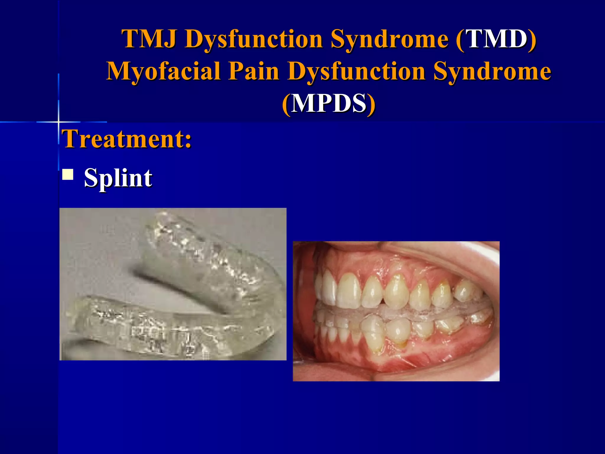 Temporomandibular joint disorder | PPT