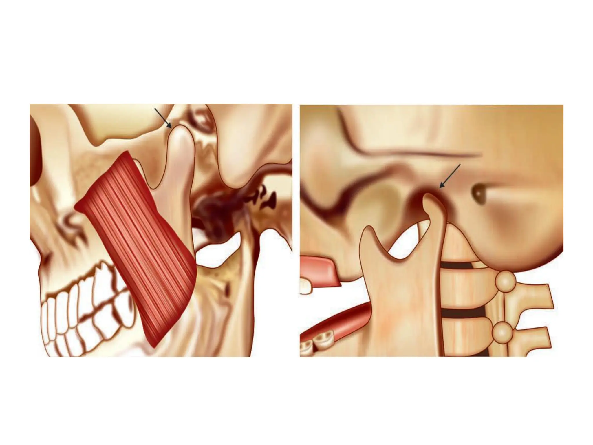Temporomandibular_joint_Disorder_Facial_Pain_I.pdf