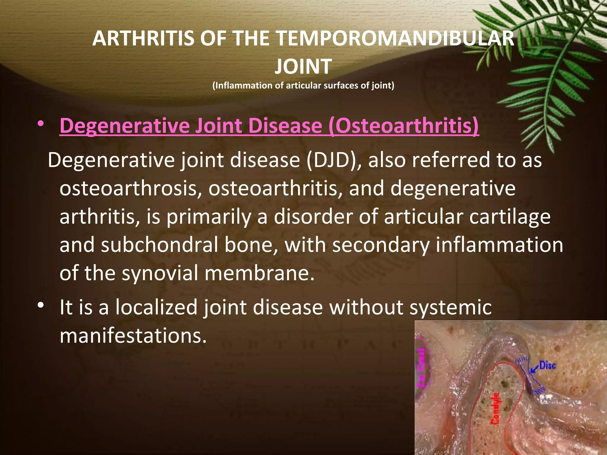 Temporomandibular joint disorders | PPT