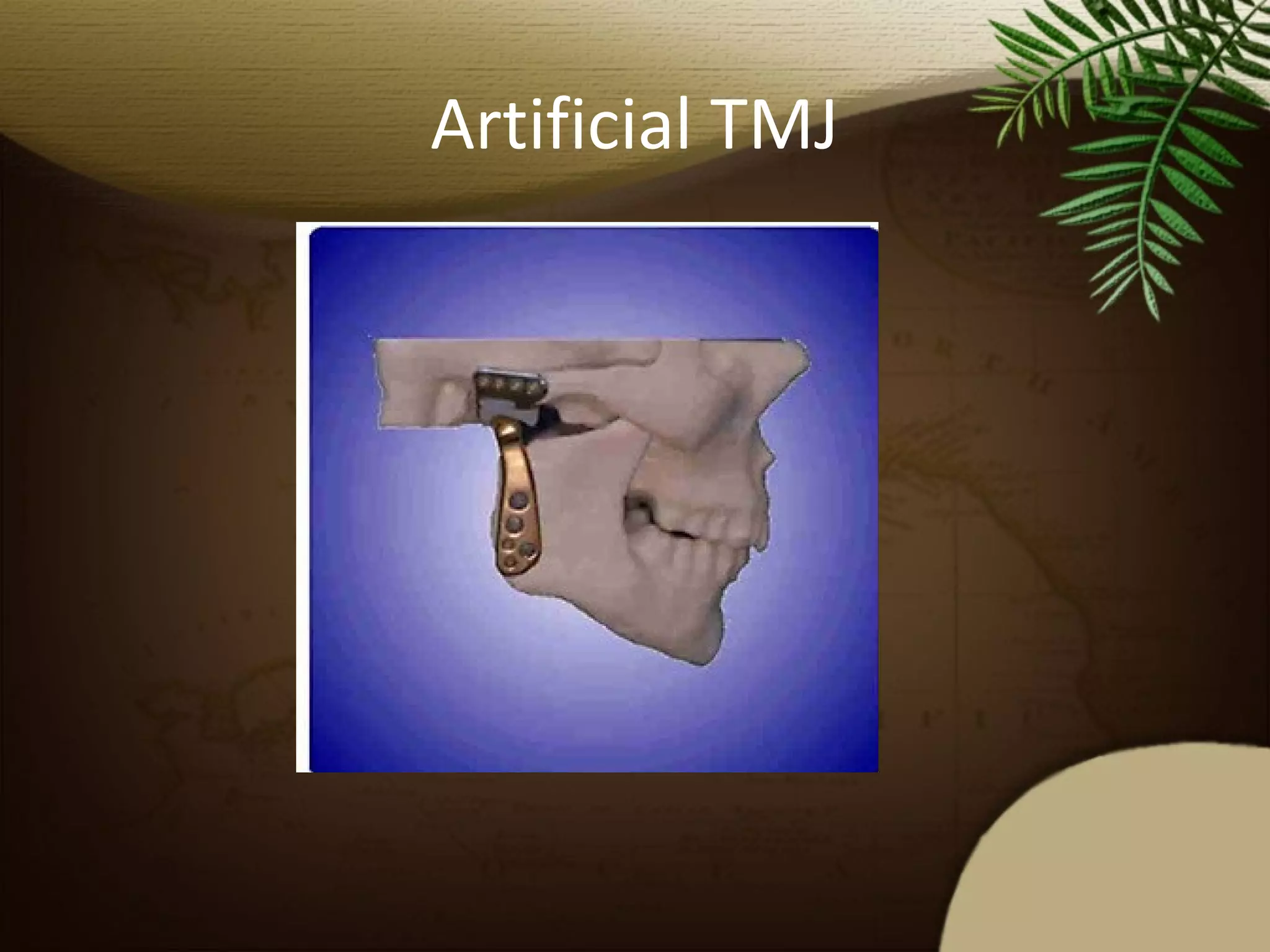 Temporomandibular joint disorders | PPT