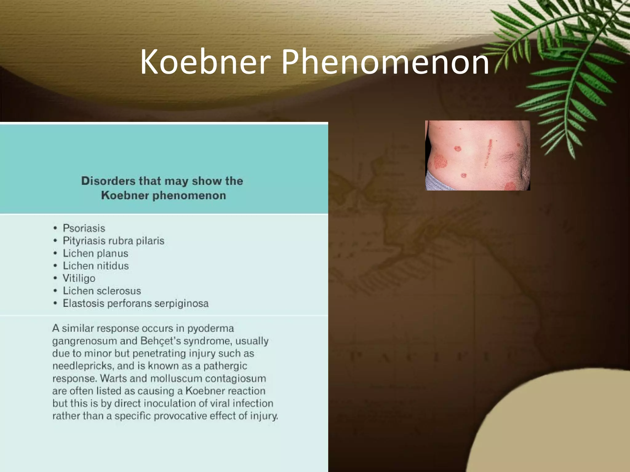 Temporomandibular joint disorders | PPT
