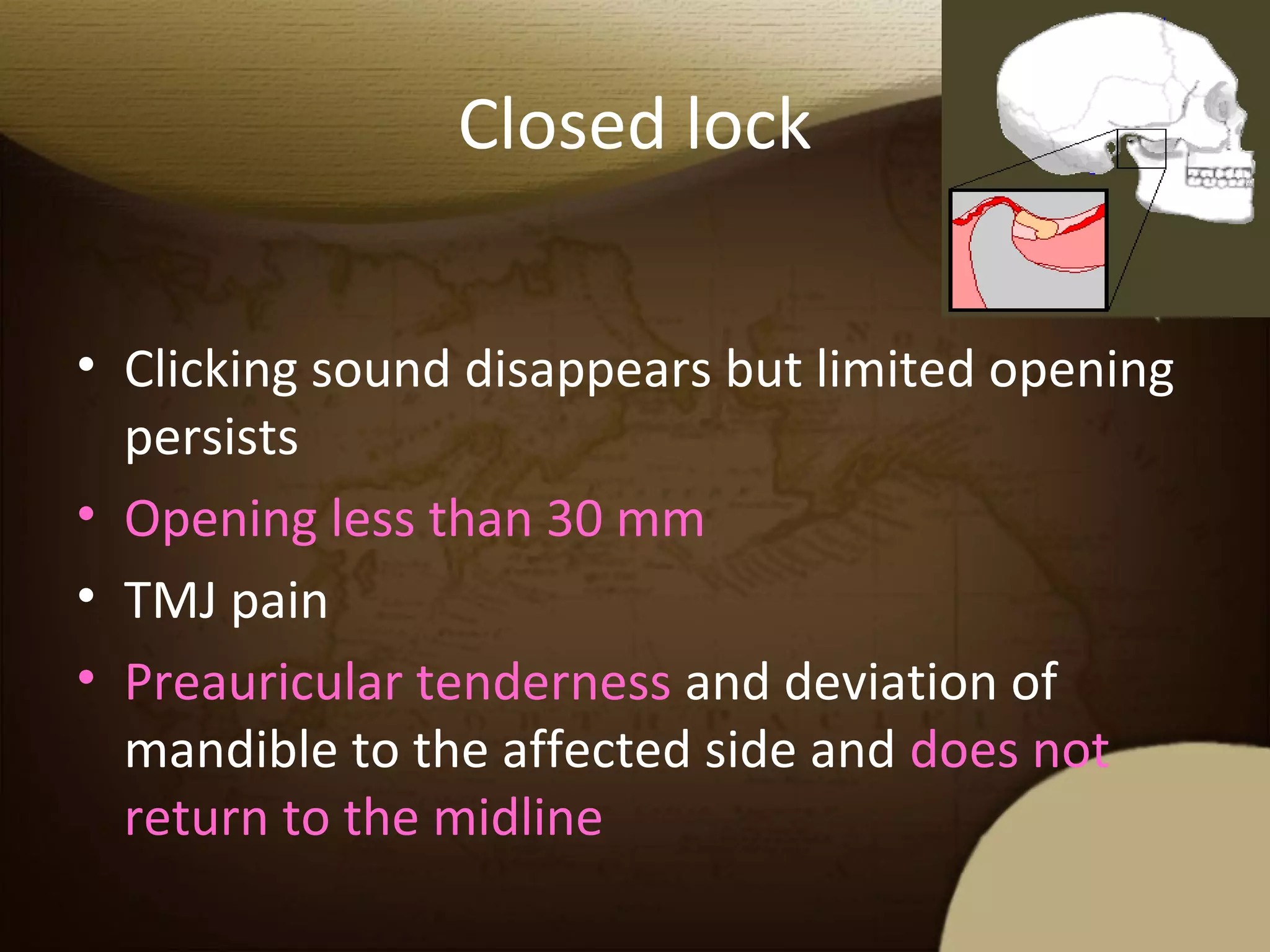 Temporomandibular joint disorders | PPT