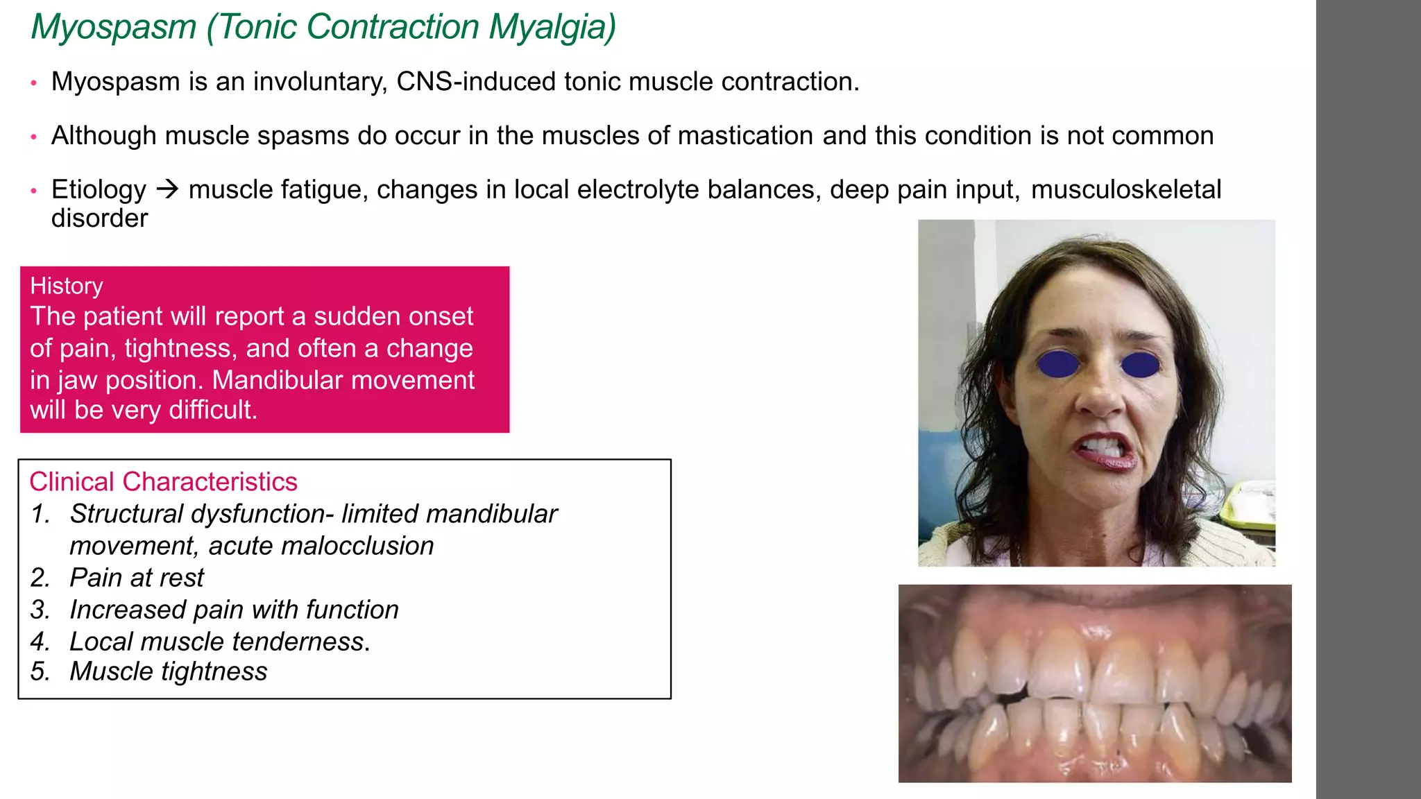 Temporomandibular joint disorders | PPTX