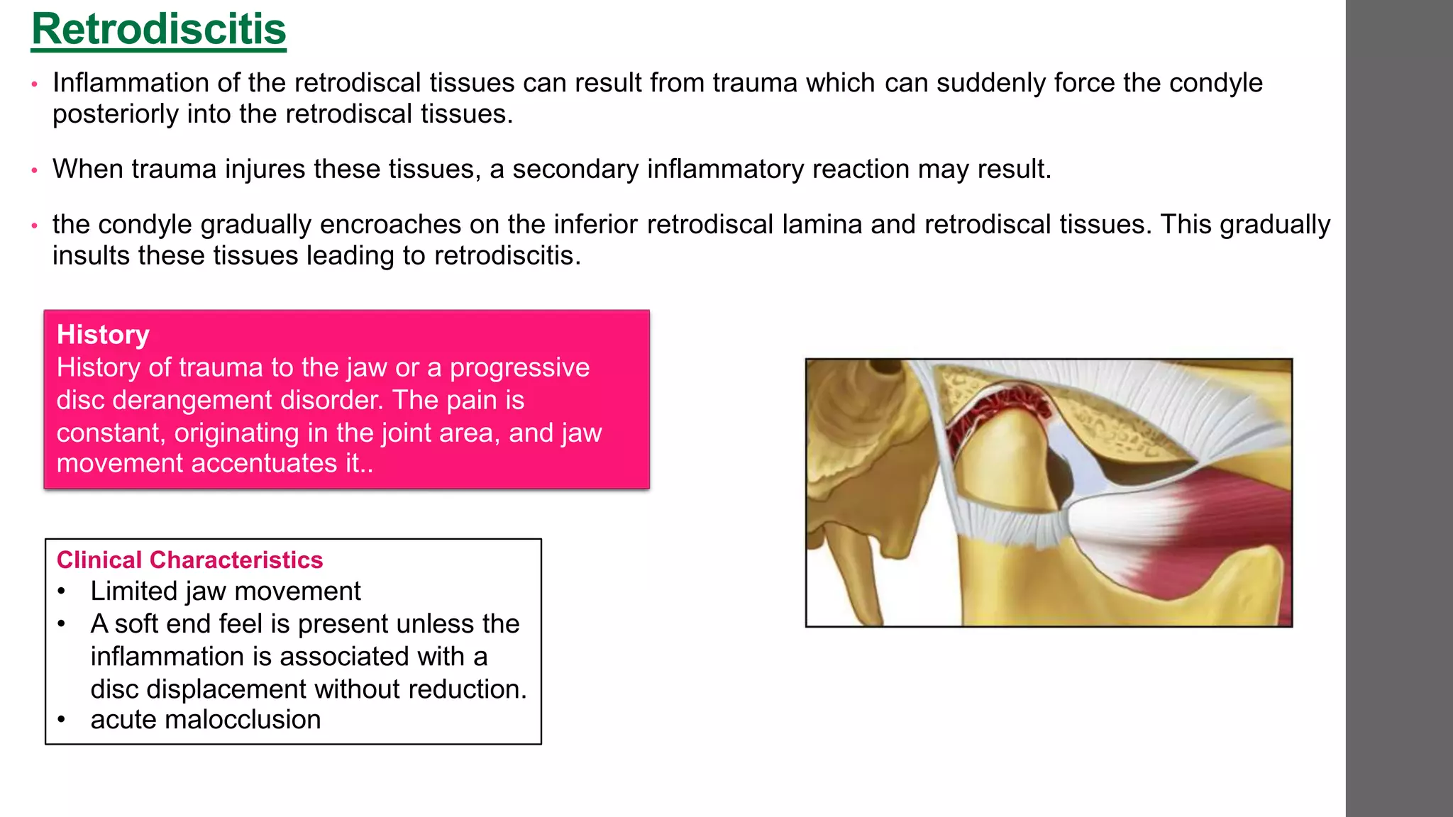 Temporomandibular joint disorders | PPTX