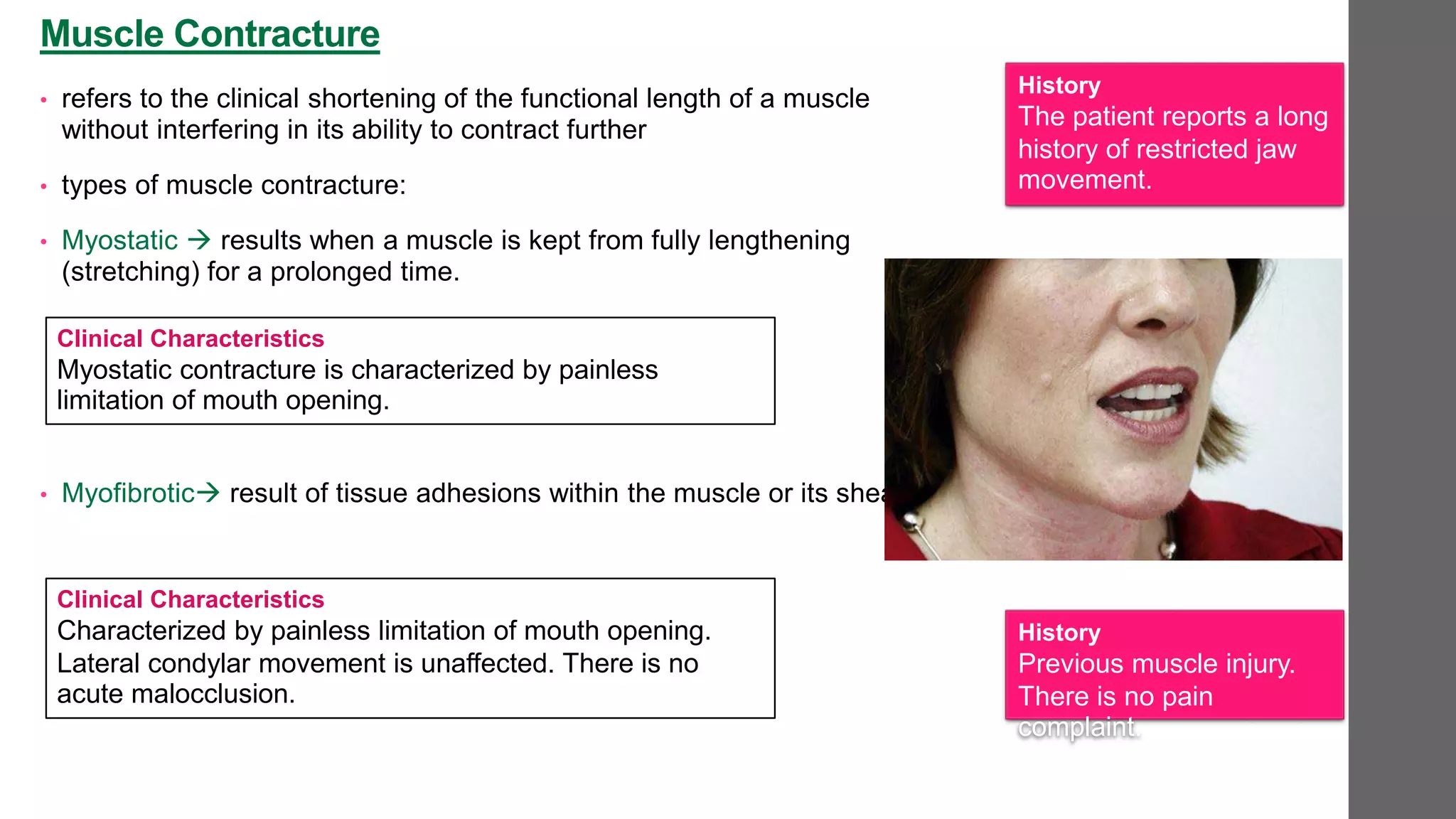 Temporomandibular joint disorders | PPTX
