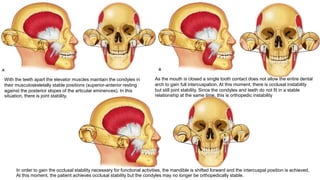 Temporomandibular joint disorders | PPTX