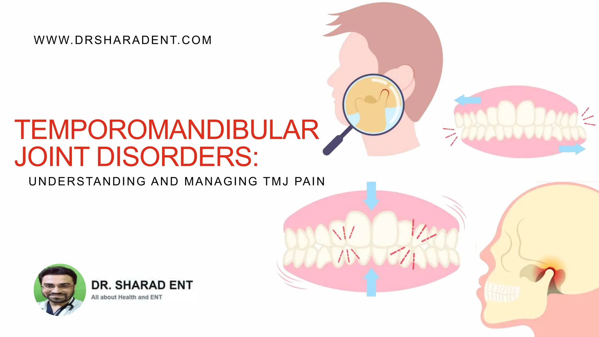 Temporomandibular Joint Disorders: Understanding and Managing TMJ Pain ...