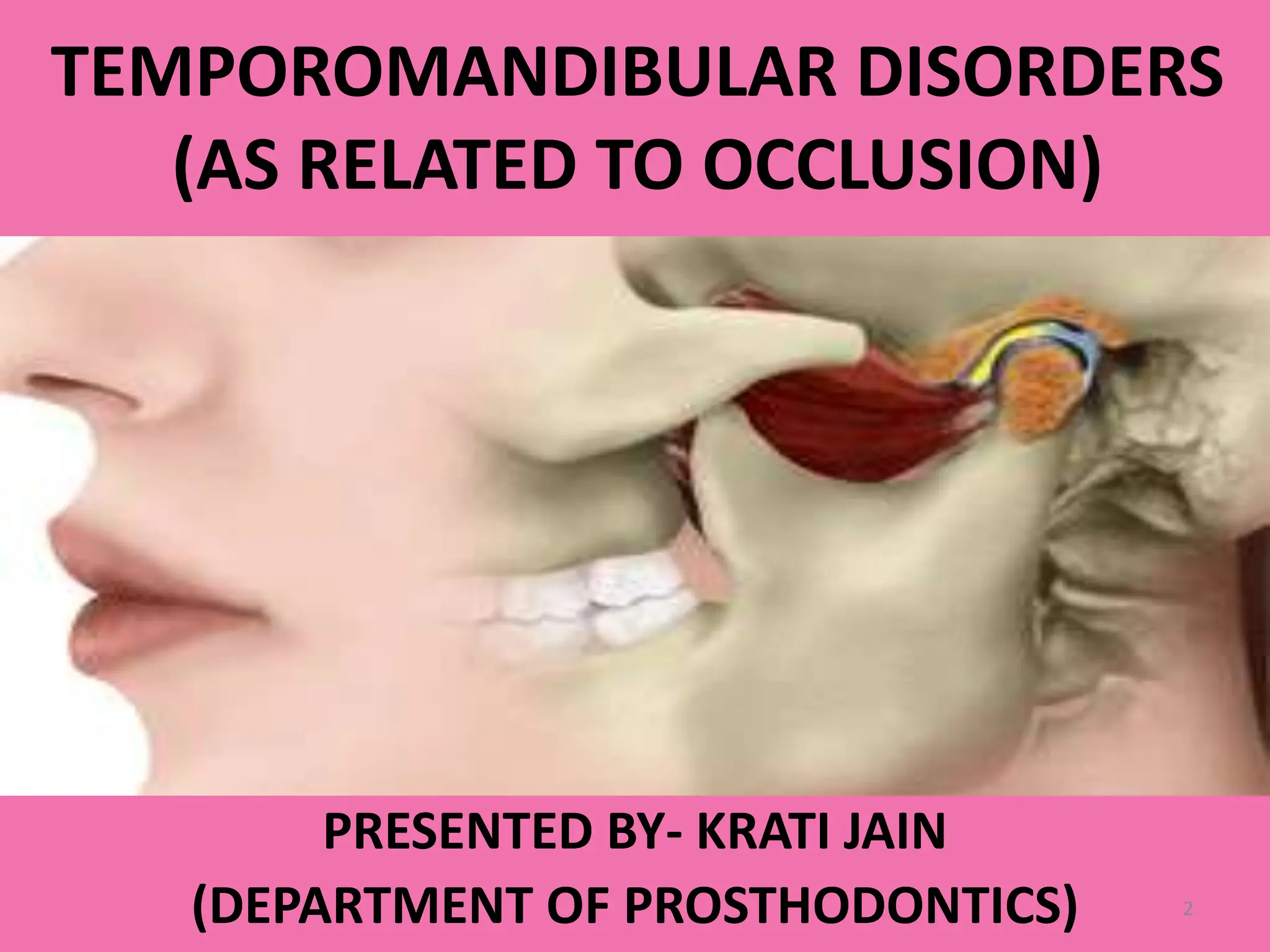 TEMPOROMANDIBULAR JOINT DISORDERS AND ITS PROSTHETIC MANAGEMENT (2 ...