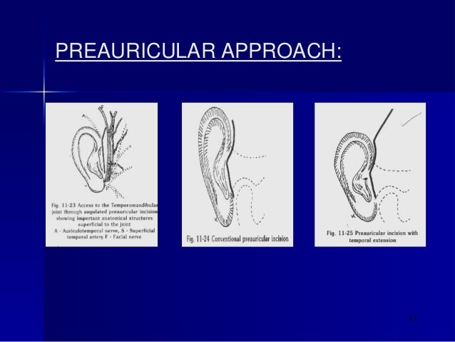 Temporomandibular joint disorders IV