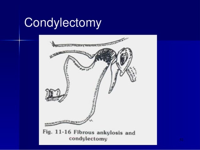 Temporomandibular joint disorders IV