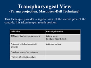 Temporomandibular joint imaging | PPTX