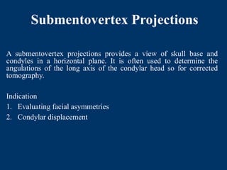 Temporomandibular joint imaging | PPTX