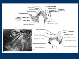 Temporomandibular joint imaging | PPTX