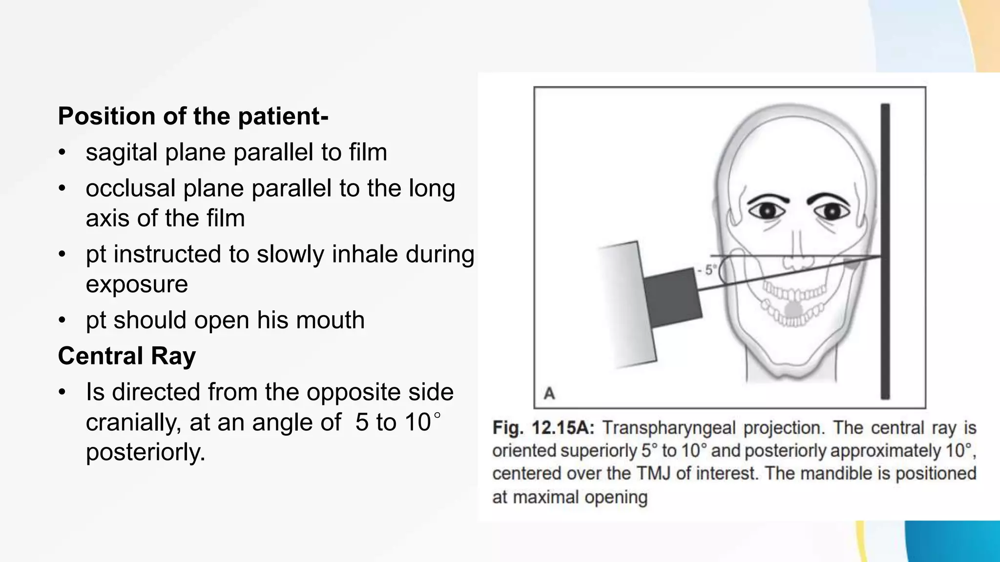 Temporomandibular joint imaging part-1 | PPTX