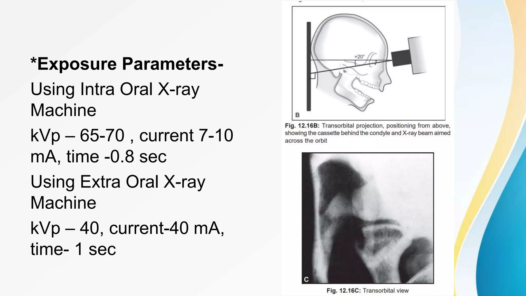 Temporomandibular joint imaging part-1 | PPTX