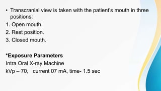 Temporomandibular joint imaging part-1 | PPTX