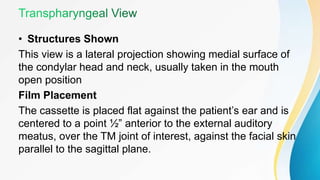 Temporomandibular joint imaging part-1 | PPTX