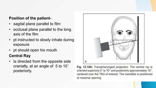 Temporomandibular joint imaging part-1 | PPTX