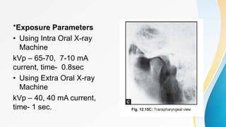 Temporomandibular joint imaging part-1 | PPTX