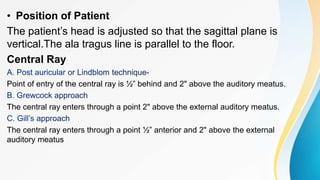 Temporomandibular joint imaging part-1 | PPTX