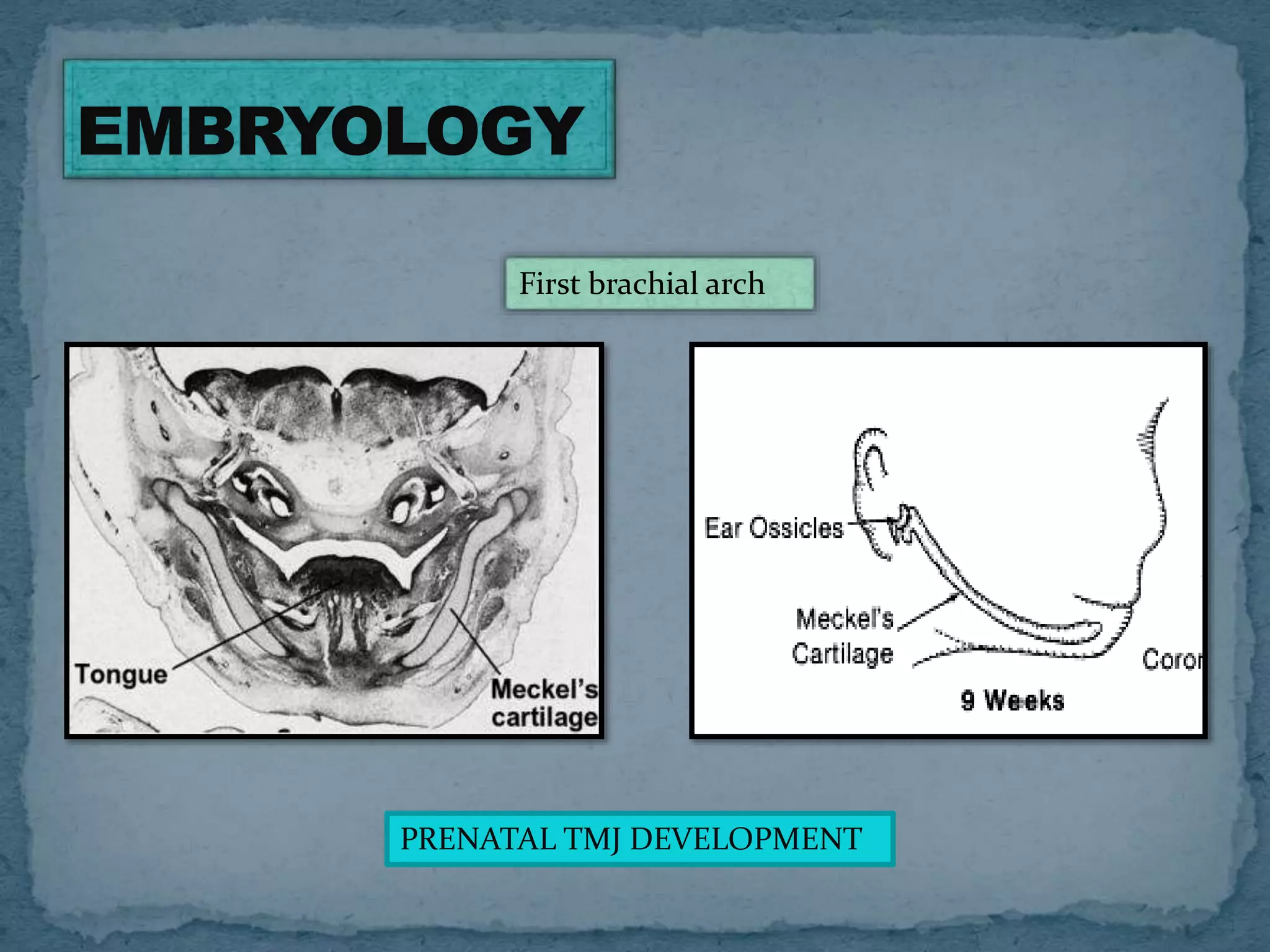 Temporomandibular joint seminar | PPTX