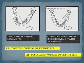 Temporomandibular joint seminar | PPTX