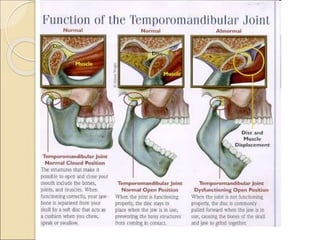 Temporomandibular joint & disorders seminar.ppt