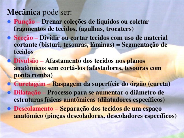 Tempos cirurgicos Tempos cirurgicos