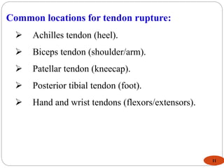 Tendinitis & Tendon rupture and tendinosis | PDF