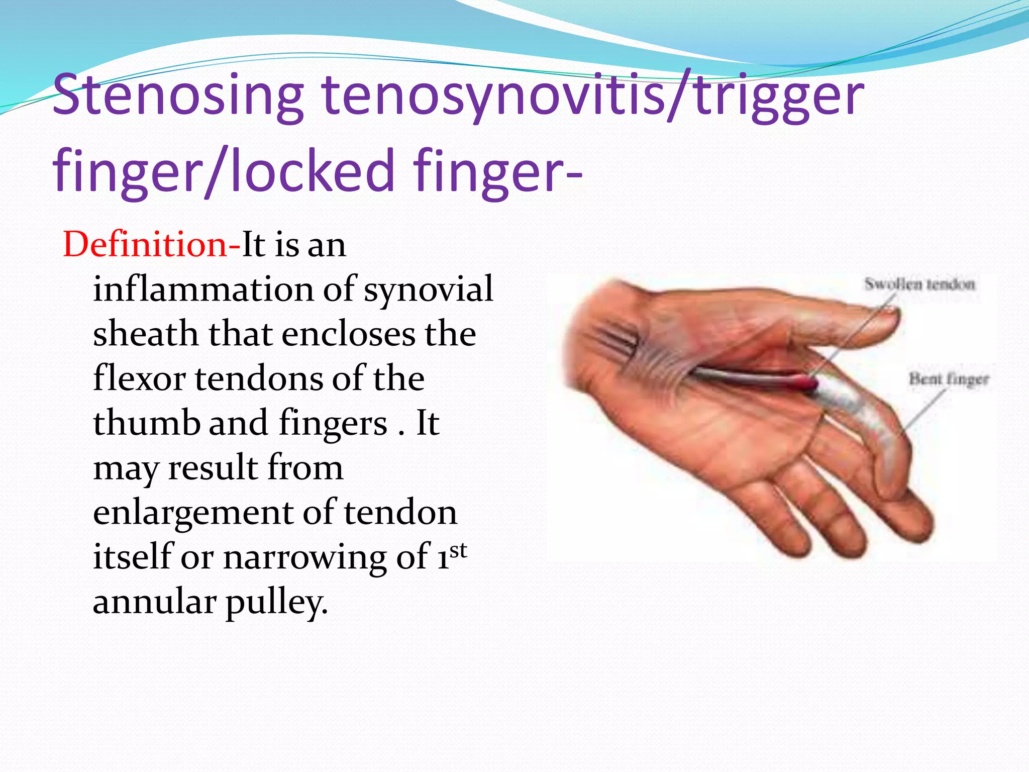 Tendinopathies of wrist and hand | PPT