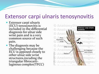 Tendinopathies of wrist and hand | PPTX