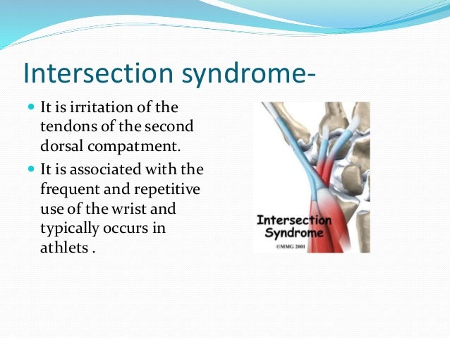 Tendinopathies of wrist and hand