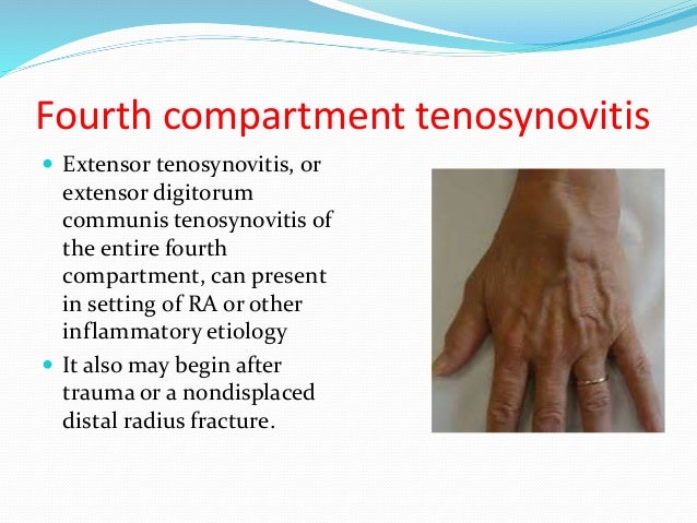 Tendinopathies of wrist and hand