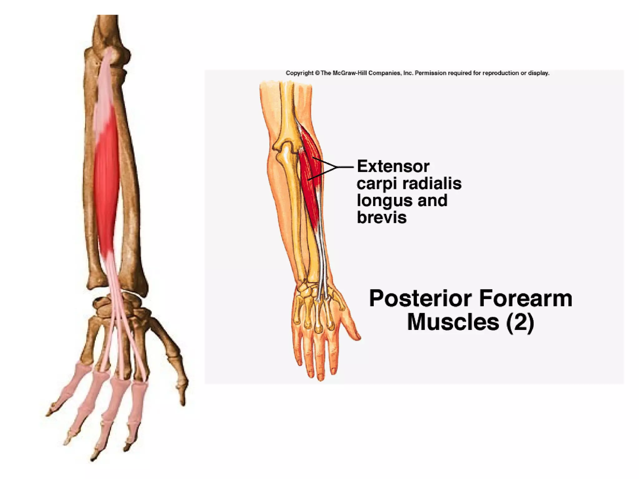Tendinopathies(tennis,golfers,dequervains,intersection syndrome) | PPT