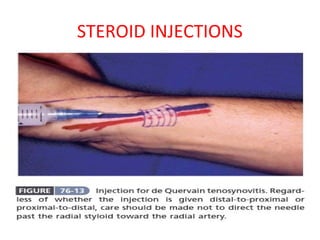 Tendinopathies(tennis,golfers,dequervains,intersection syndrome) | PPT