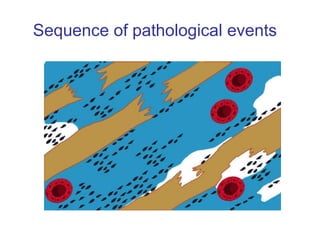 Tendinopathy I Dr.RAJAT JANGIR JAIPUR | PPTX