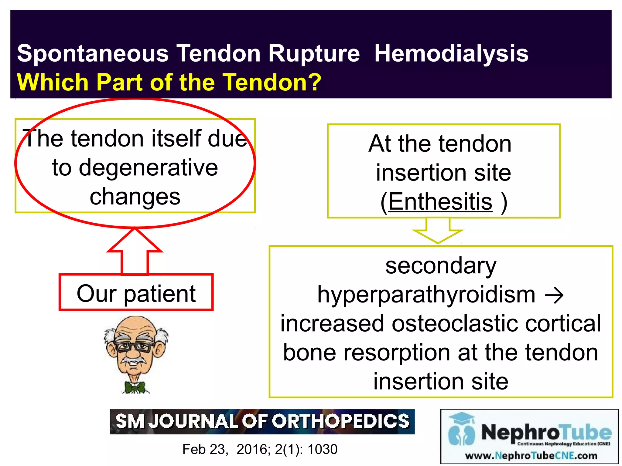Spontaneous Achilles Tendon Rupture in HD Patient - Dr. Gawad | PPT