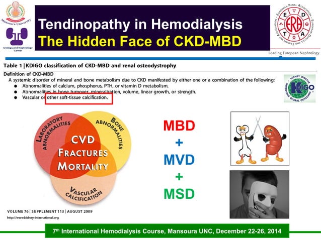 Tendinopathy in Hemodialysis Patients (The Hidden Face of CKD-MBD) - Dr ...