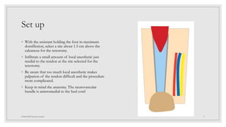 Tendo Achilles tenotomy as a part of Ponsetti technique | PPTX
