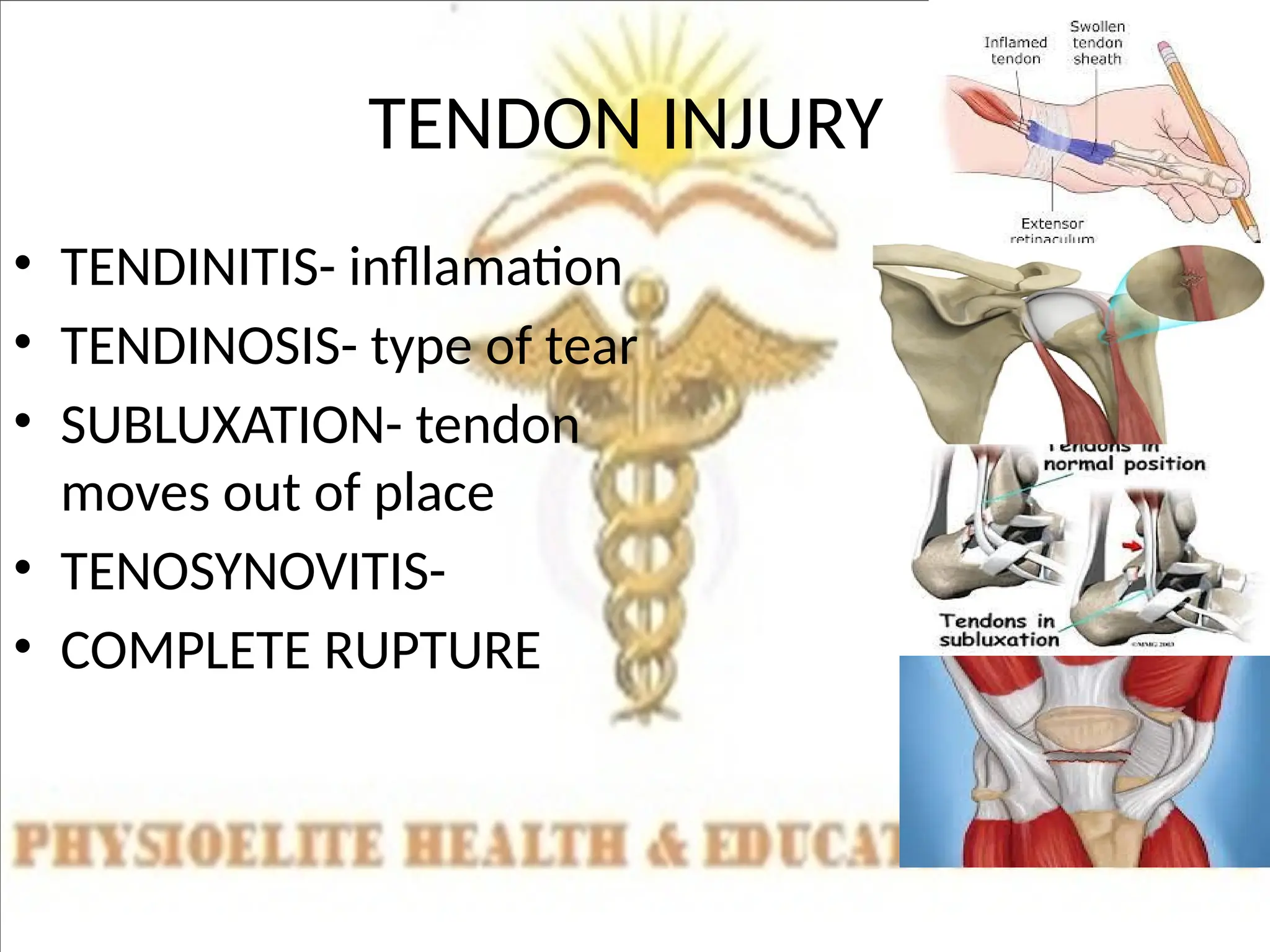 TENDON.pptx Know about tendon, and components of tendon, tendon injury ...