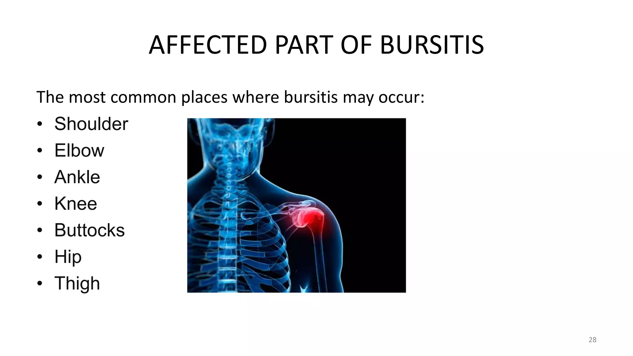 Tendon and ligament injureies | PPTX