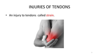 Tendon and ligament injureies | PPTX