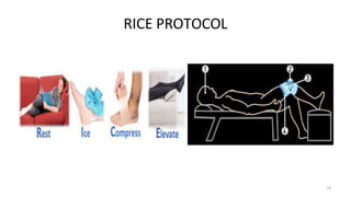 Tendon and ligament injuries - Basics.pptx