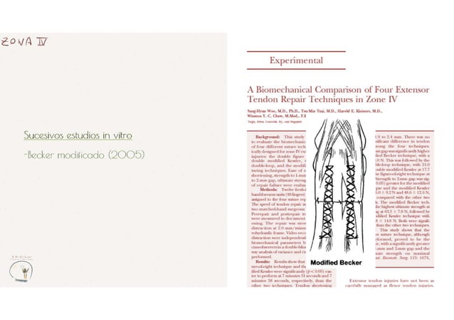 Lesiones de los Tendones Extensores de la Mano - Dr. Alex Ortiz Espada ...