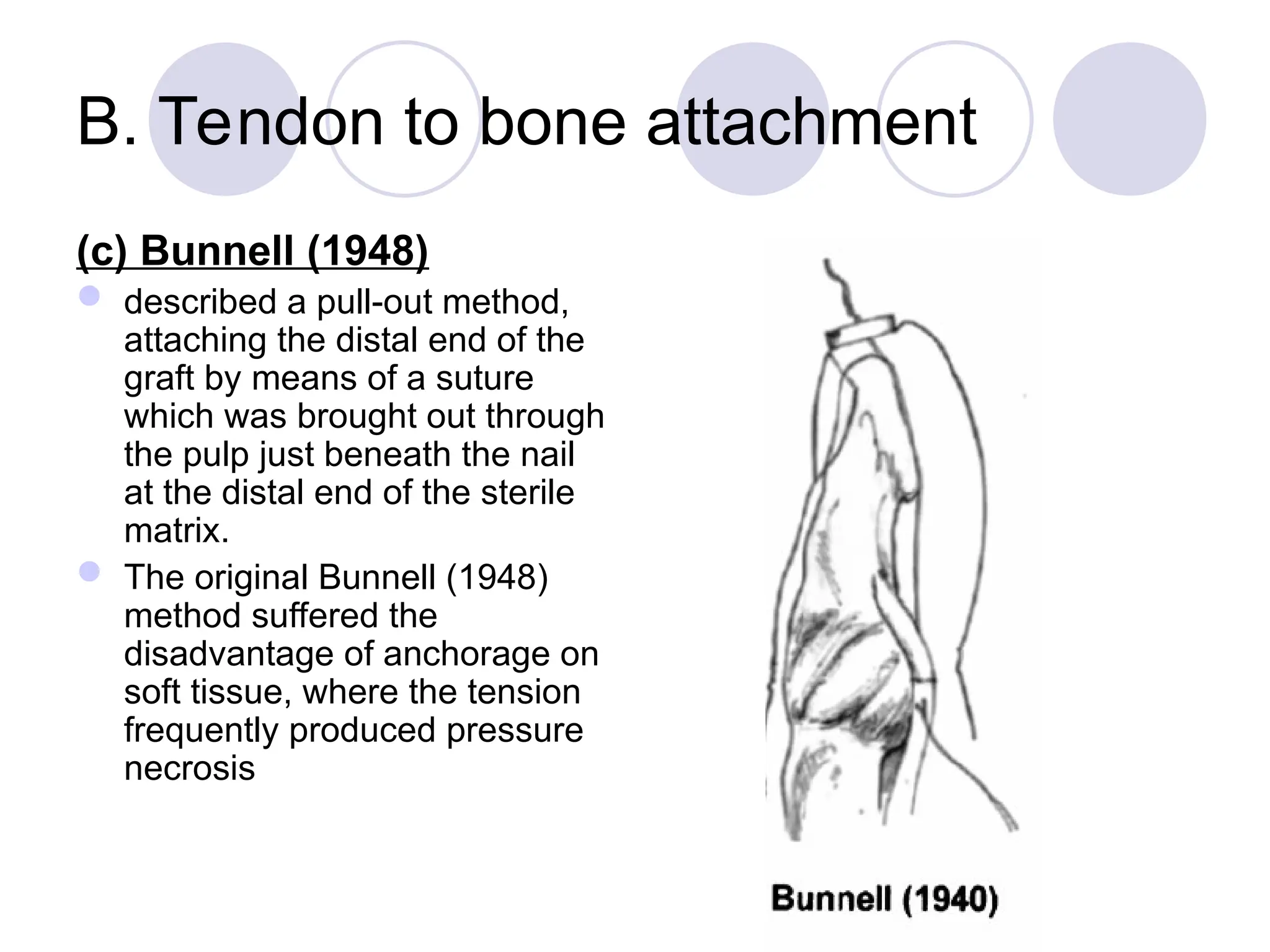 flexor TENDON GRAFTING one and two stage.ppt