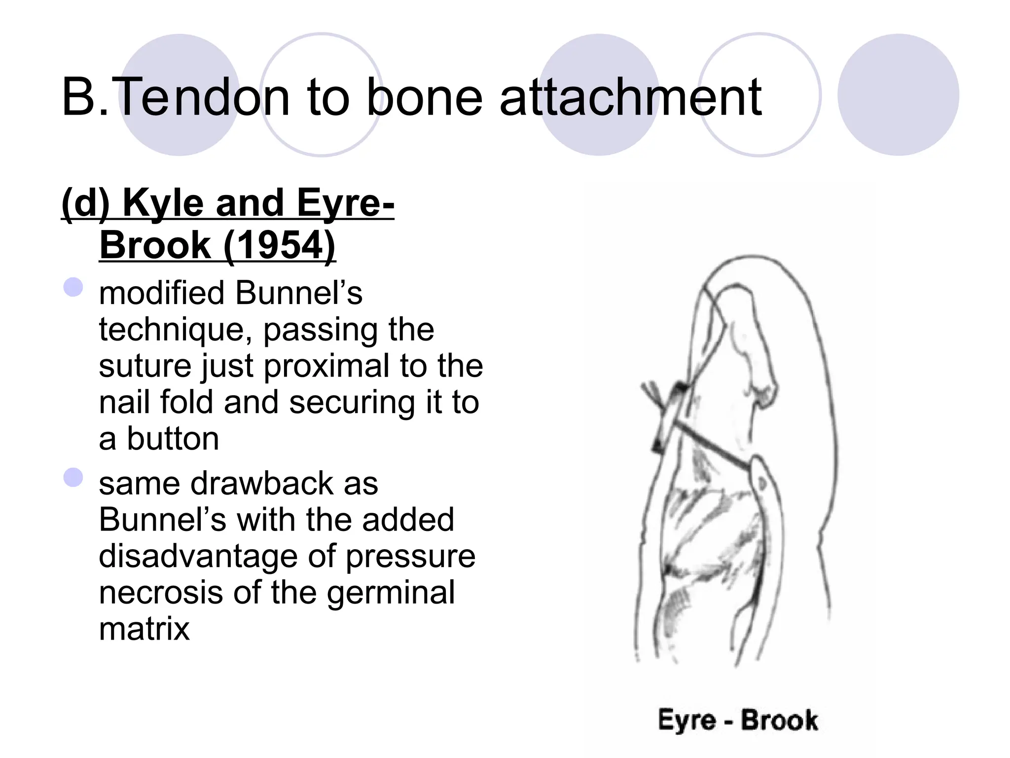 flexor TENDON GRAFTING one and two stage.ppt