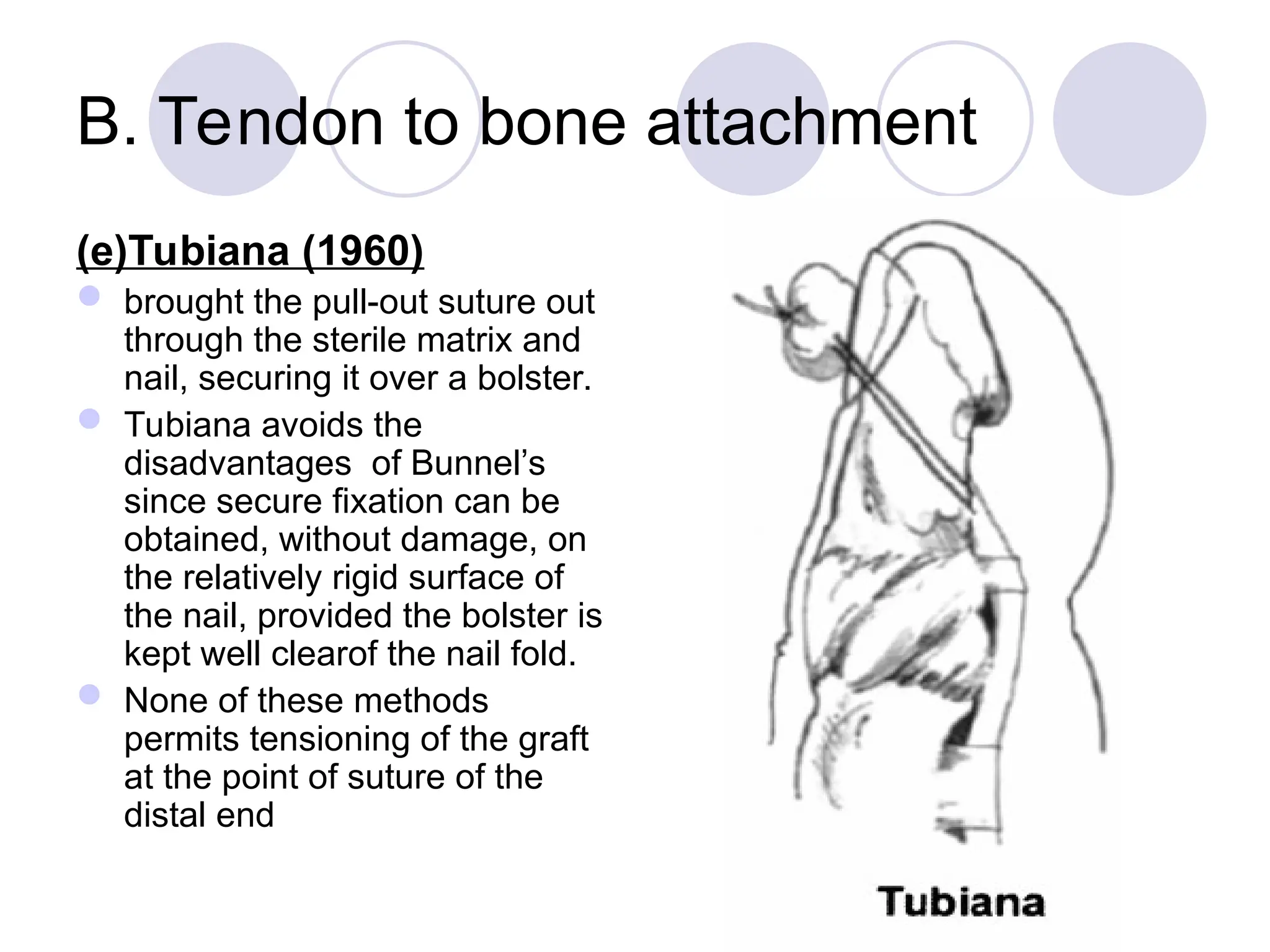flexor TENDON GRAFTING one and two stage.ppt